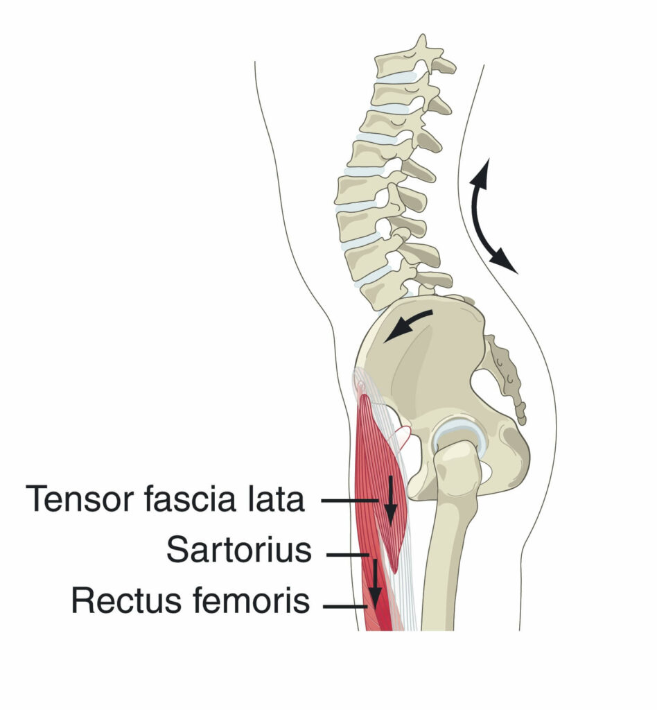 Rick Olderman | Got Lower Back Pain?
